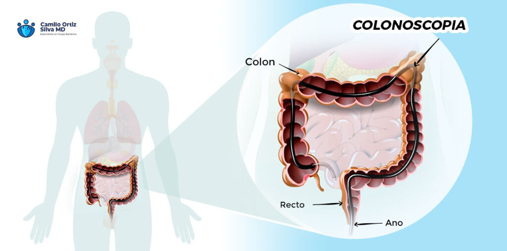 Doctor Camilo Ortiz - Colonoscopia en Bogotá, Colombia